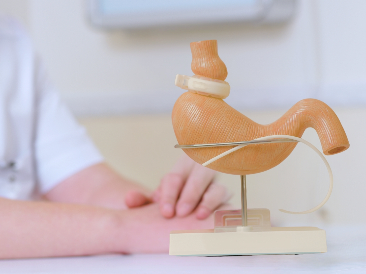 What is Gastric Tube? - Prof. Dr. Ahmet Türkçapar